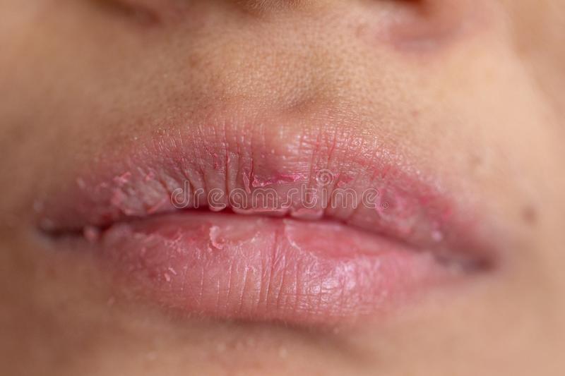 Labios Secos: Causas y Beneficios del Colágeno – b2health.es